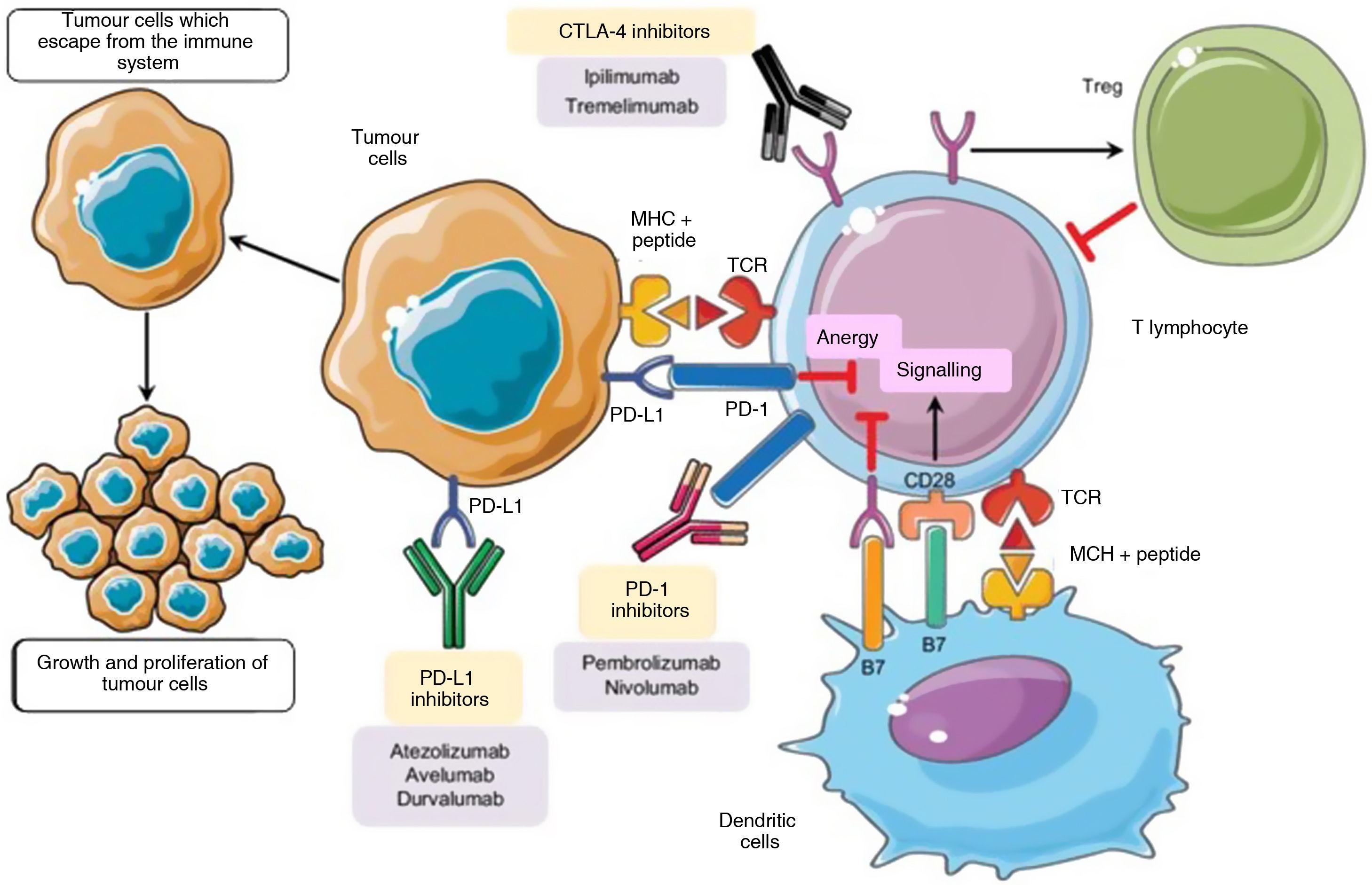 Rheumatological adverse events secondary to immune checkpoint ...