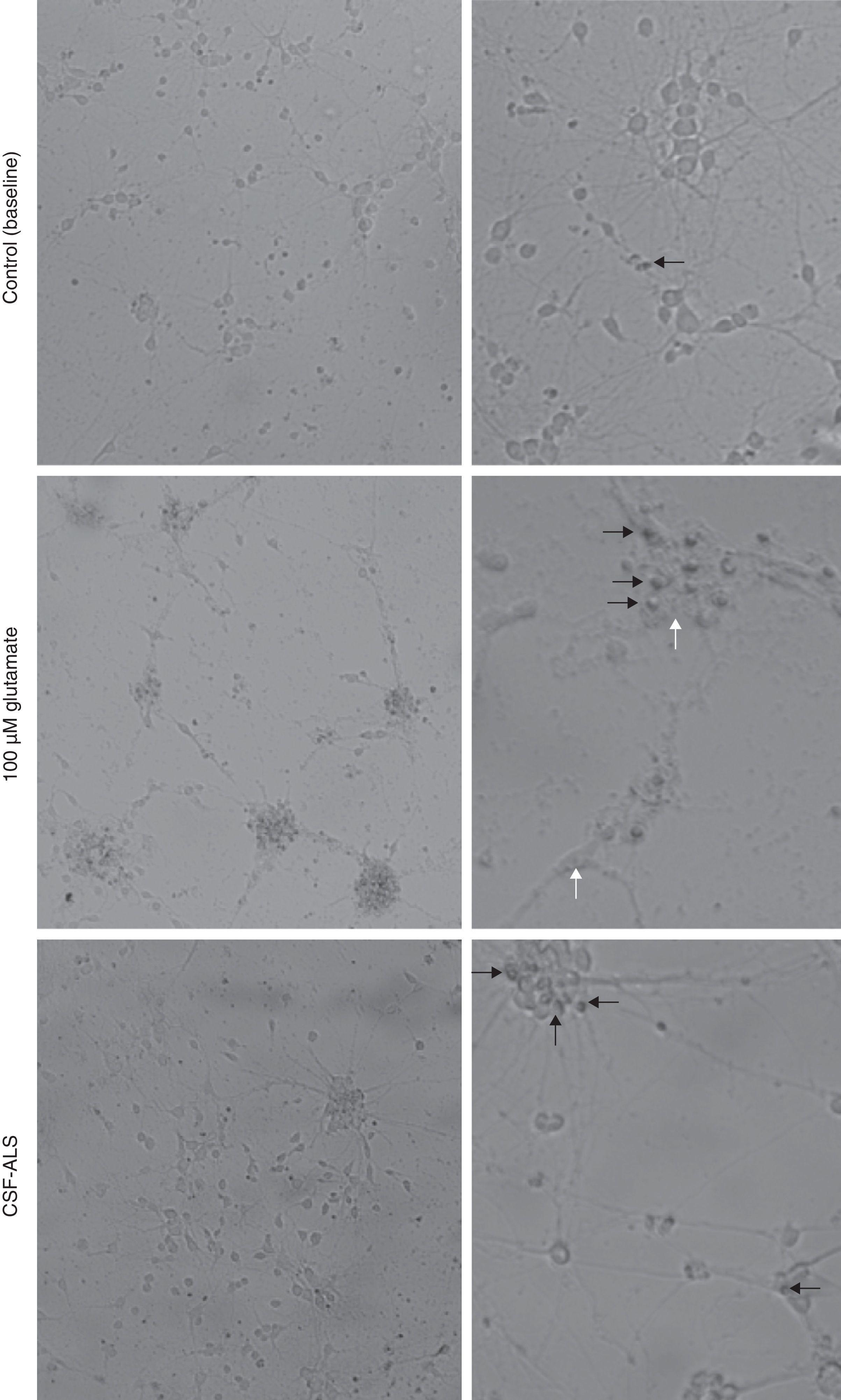 Cellular changes in motor neuron cell culture produced by cytotoxic ...