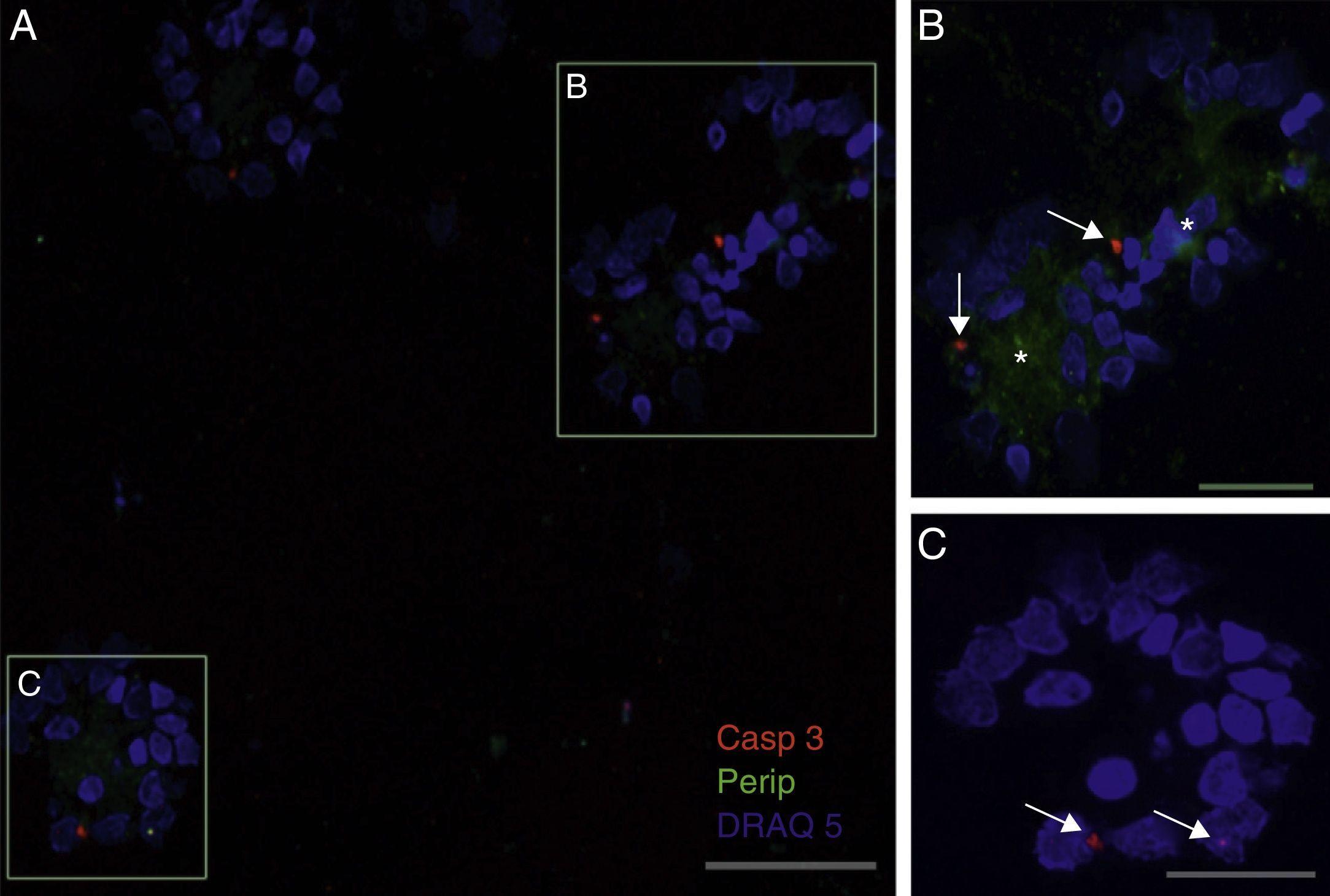 Cellular changes in motor neuron cell culture produced by cytotoxic ...