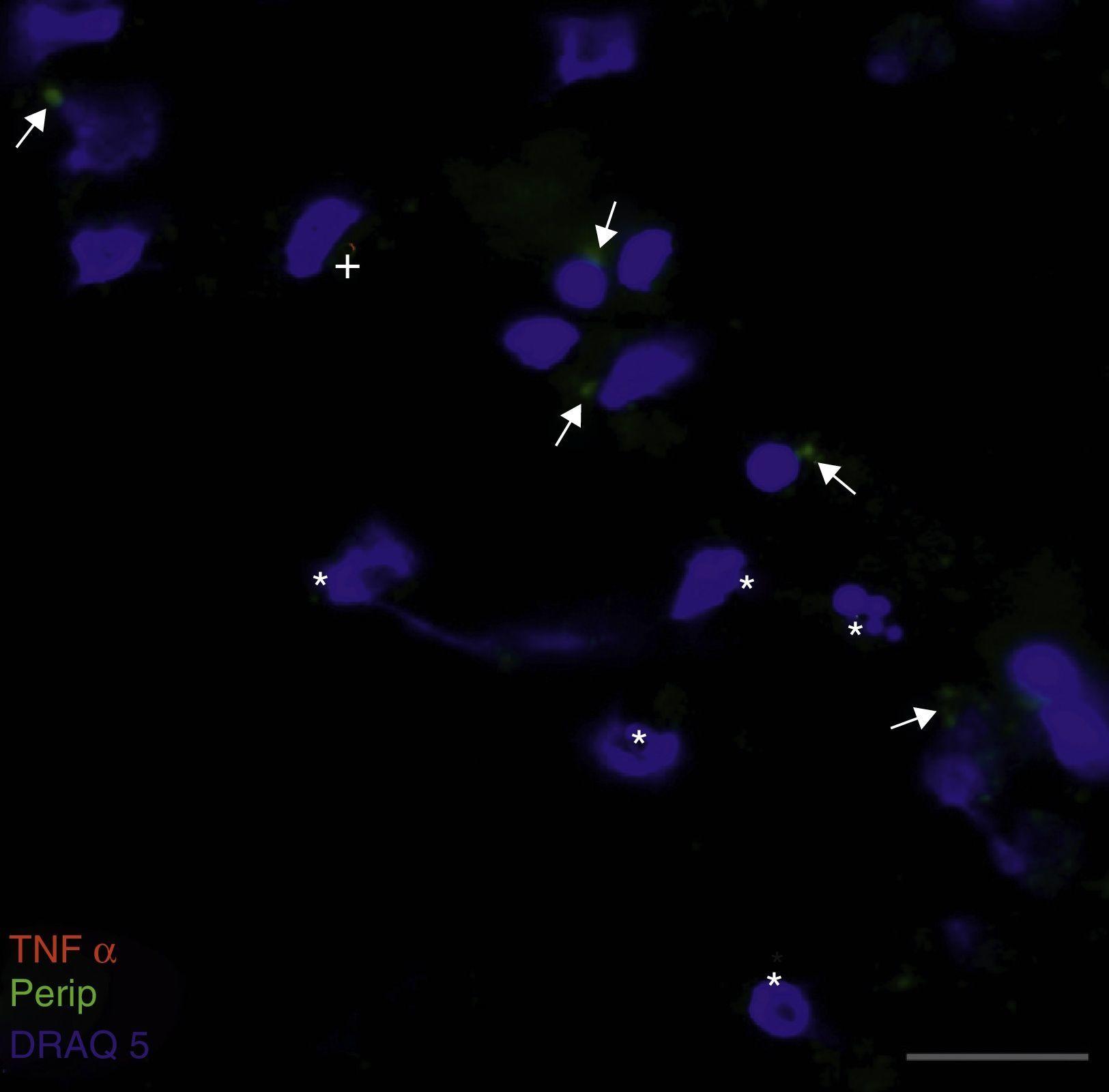 Cellular changes in motor neuron cell culture produced by cytotoxic ...