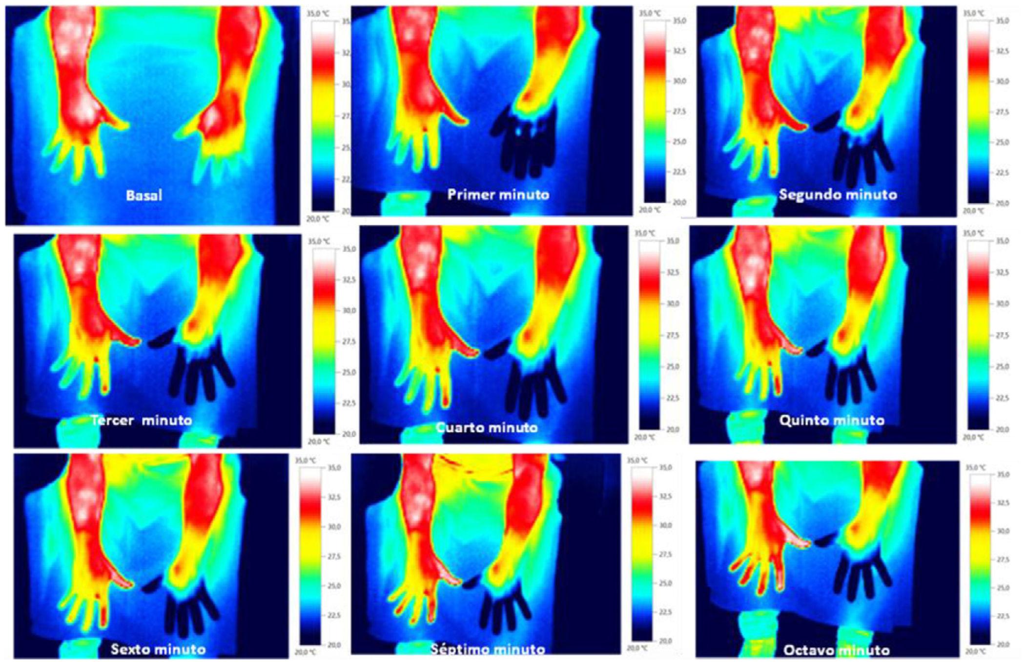 Usefulness of thermography in the diagnosis and classification of ...
