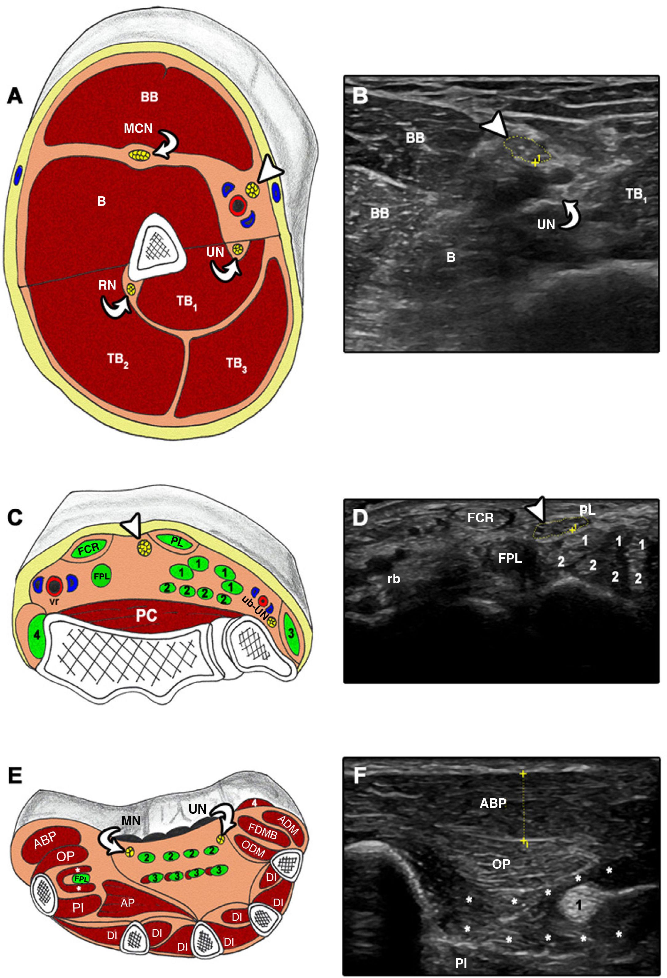 Dynamic analysis of muscles and the internal structure of the ...