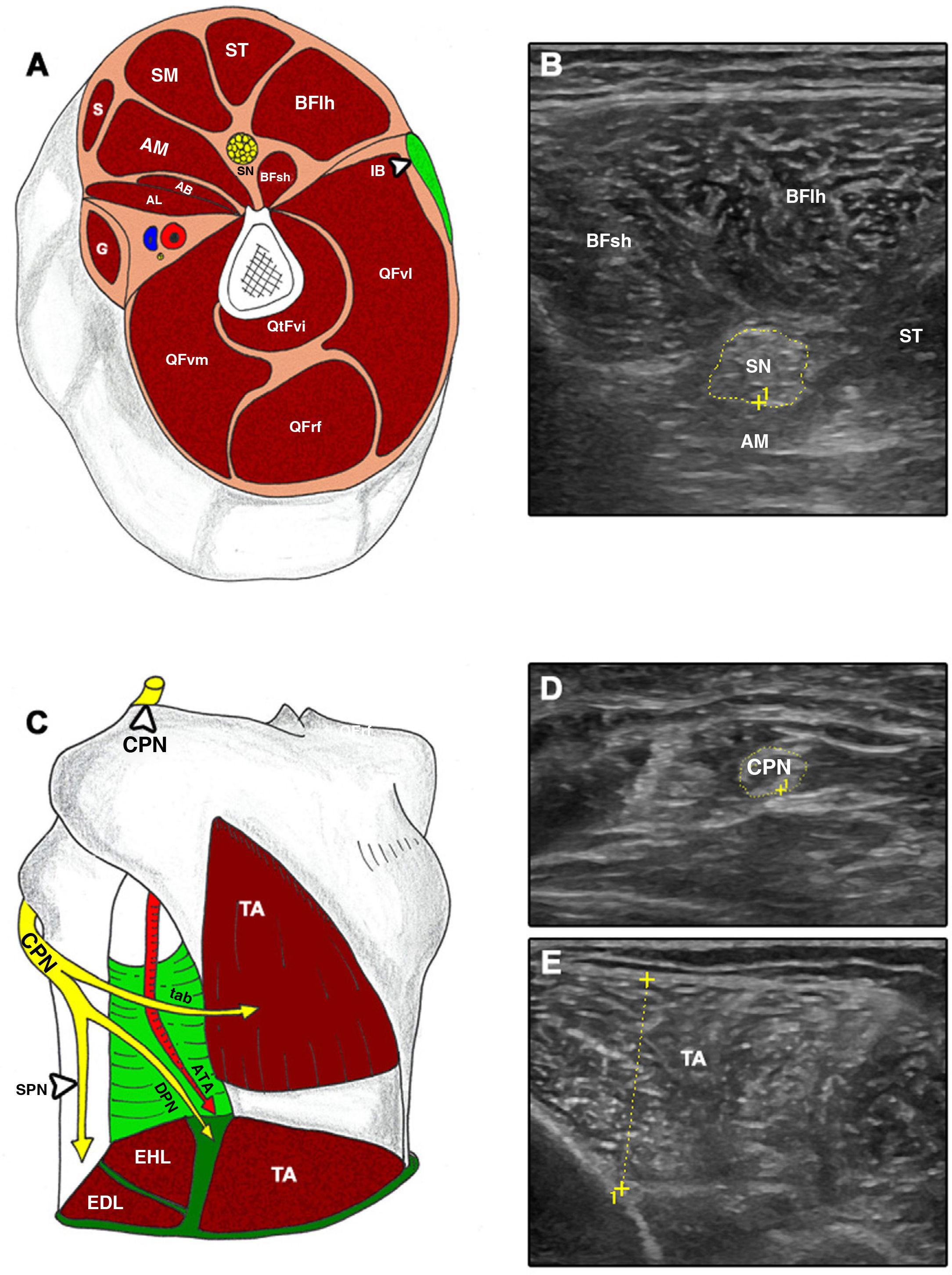 Dynamic analysis of muscles and the internal structure of the ...