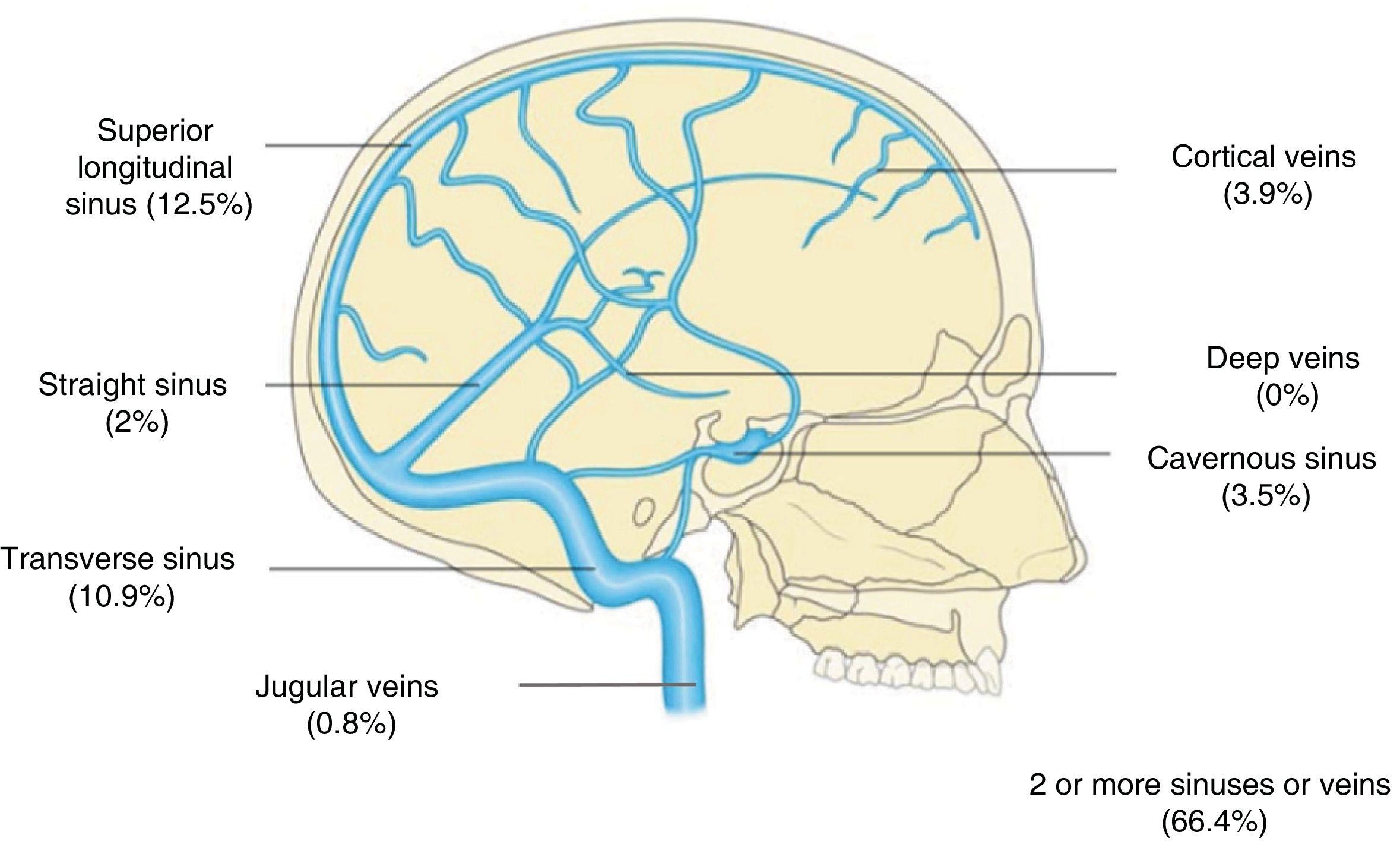Management of cerebral venous thrombosis in Spain: MOTIVATE descriptive ...