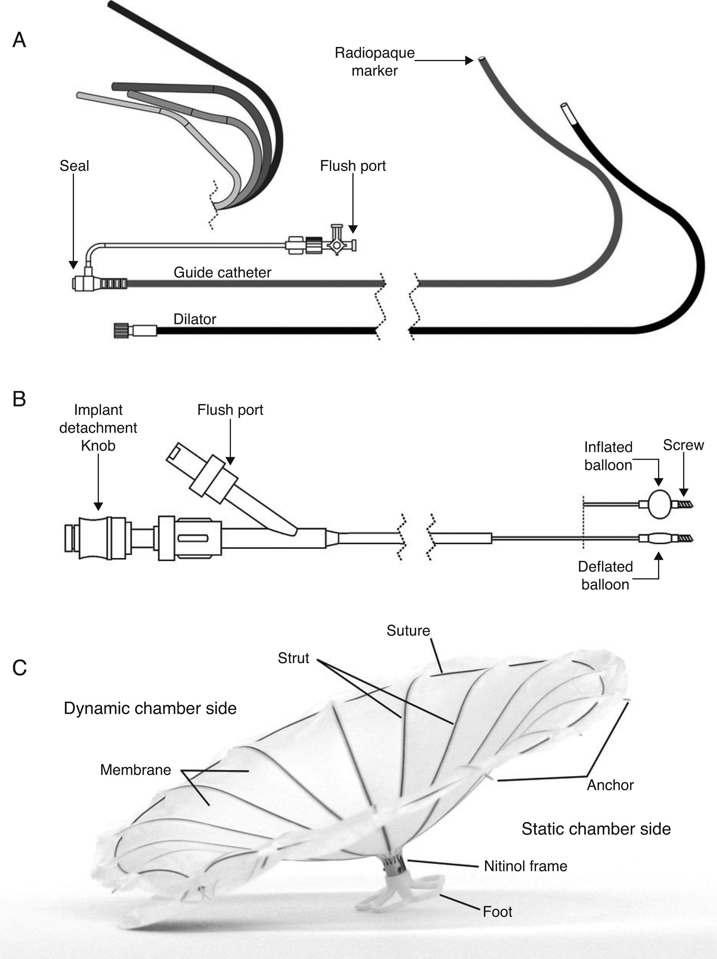 Percutaneous implantation of a ventricular partitioning device for ...