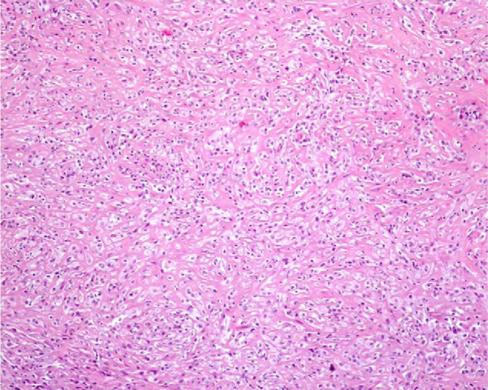 A rare cause of pericardial disease | Revista Portuguesa de Cardiologia ...