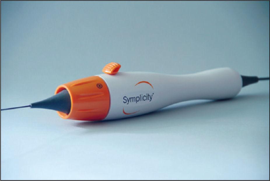 Renal Sympathetic Denervation for Treatment of Resistant Hypertension ...