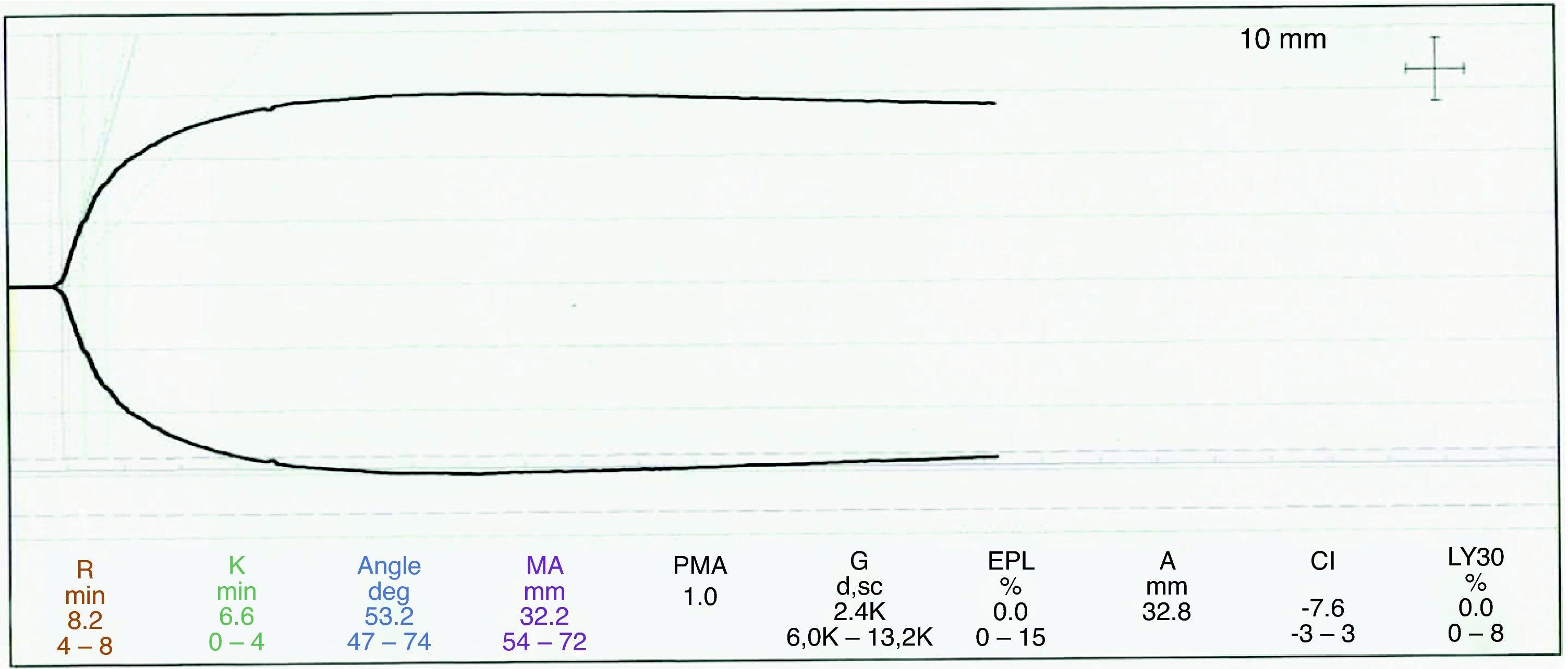Thromboelastography as a guide for transfusion therapy in a patient ...