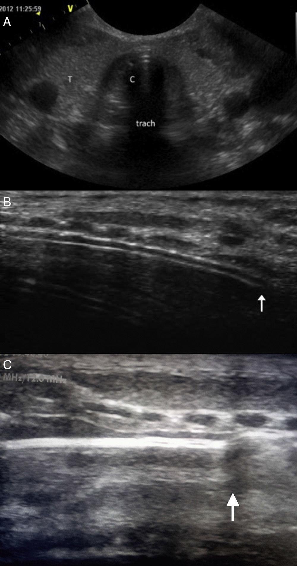 Usefulness of bedside ultrasound compared to capnography and X-ray for ...