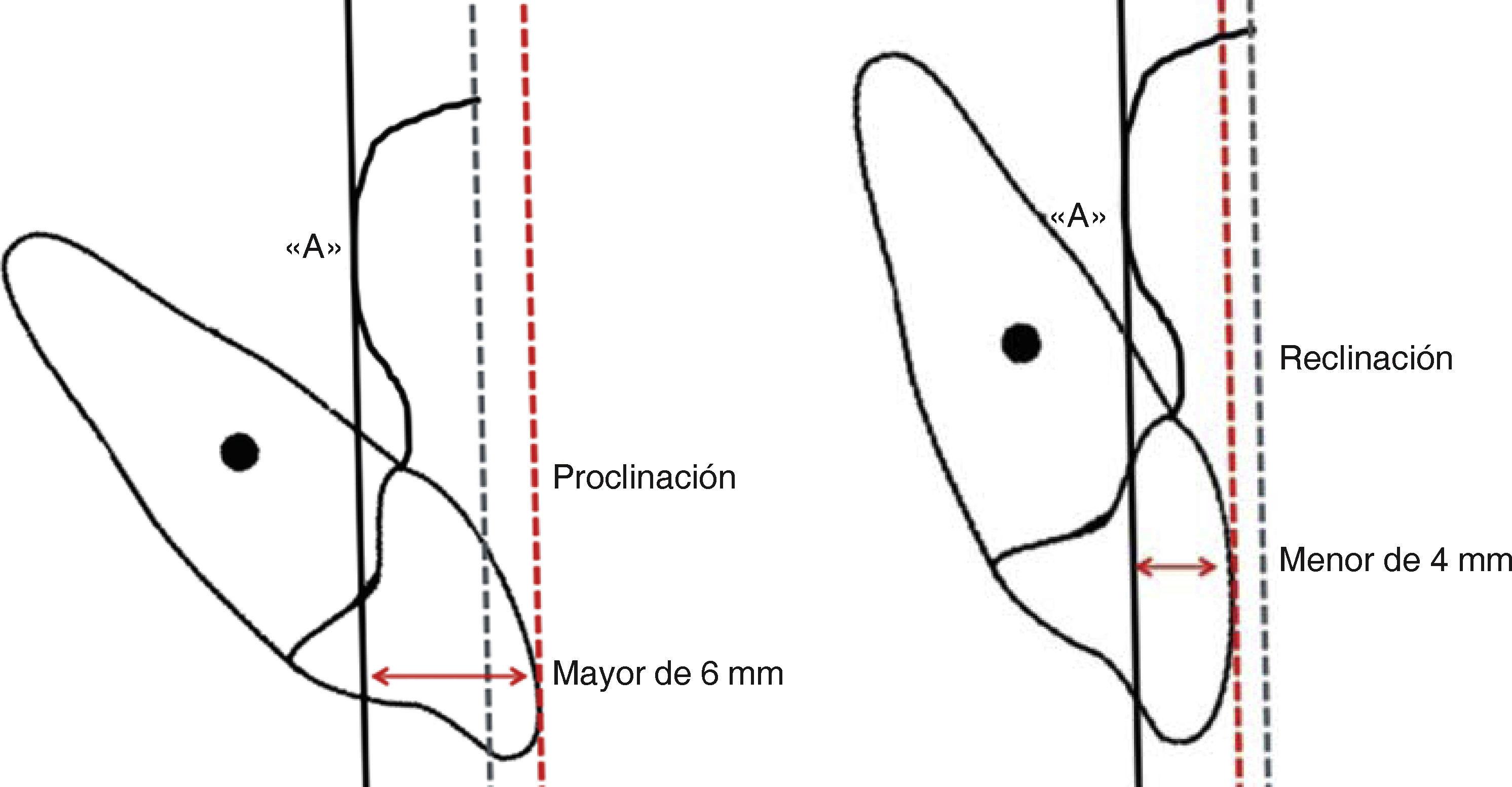 Diagnóstico cefalométrico sagital en Power Point (Microsoft® Office ...