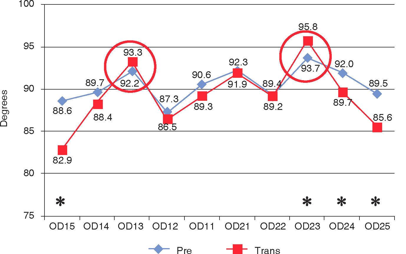 Radiographical assessment of initial and final tipping in 60 patients ...
