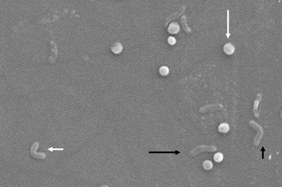Role of Helicobacter pylori coccoid forms in infection and ...