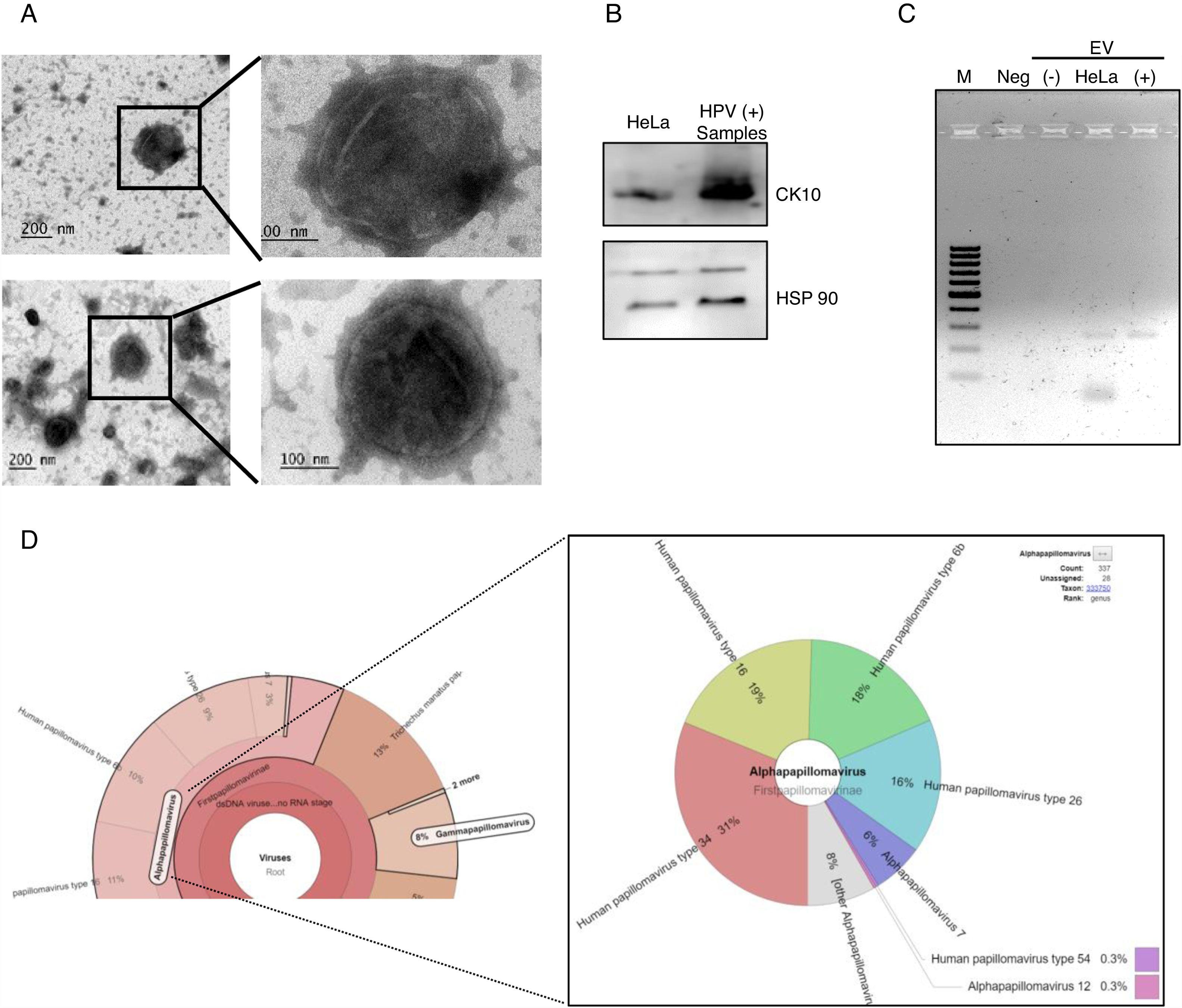 Presence of HPV DNA in extracellular vesicles from HeLa cells and ...