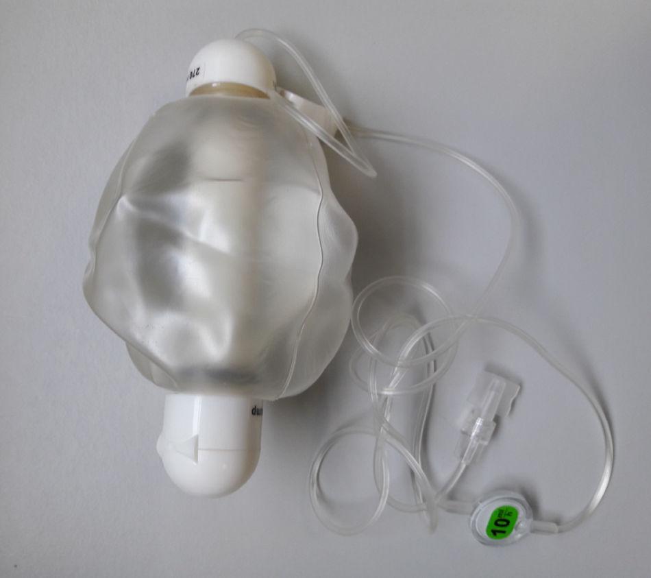 Home intravenous antibiotic therapy – Preliminary experience of a ...