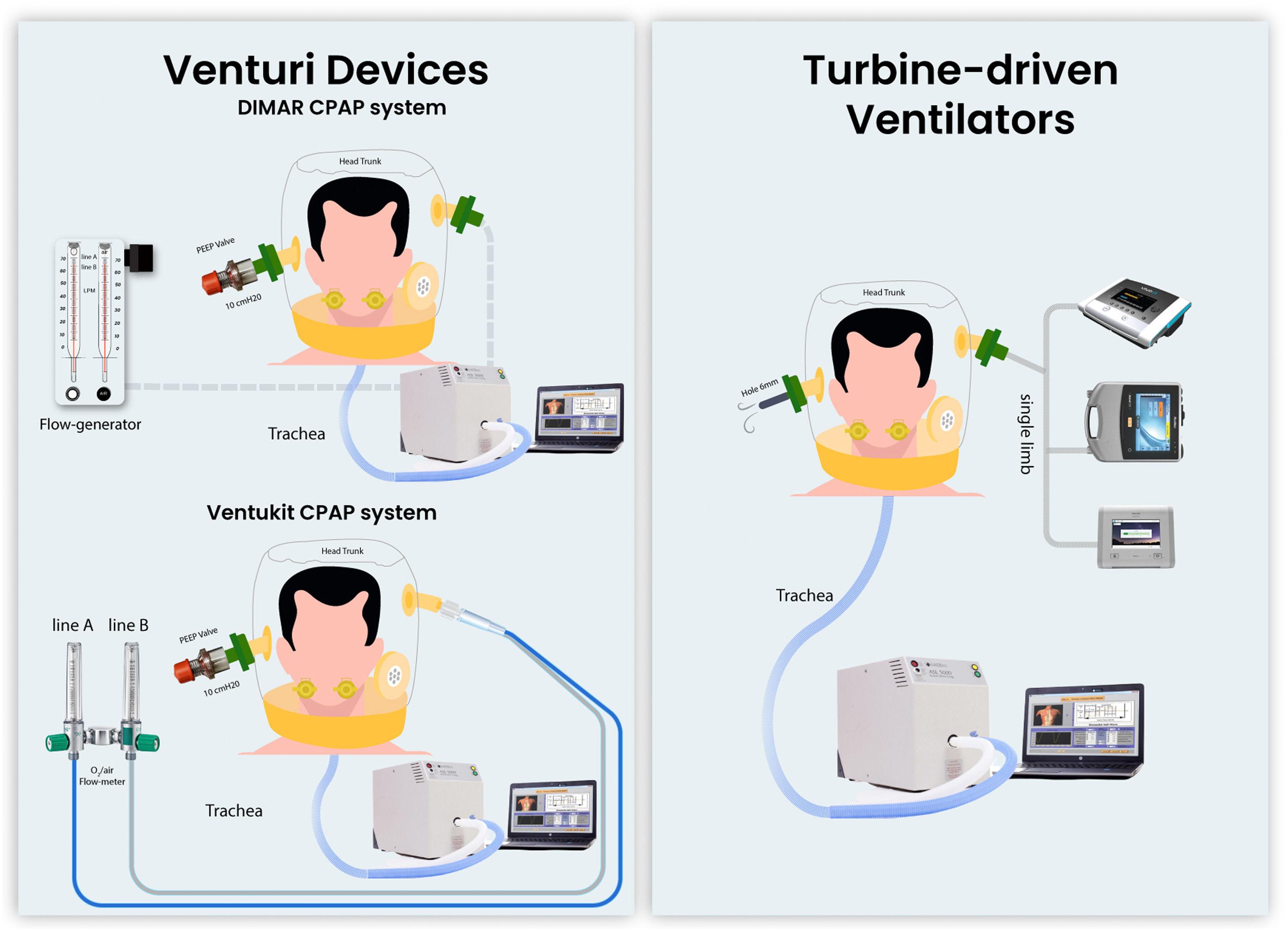 Performance of helmet CPAP using different configurations: Turbine ...