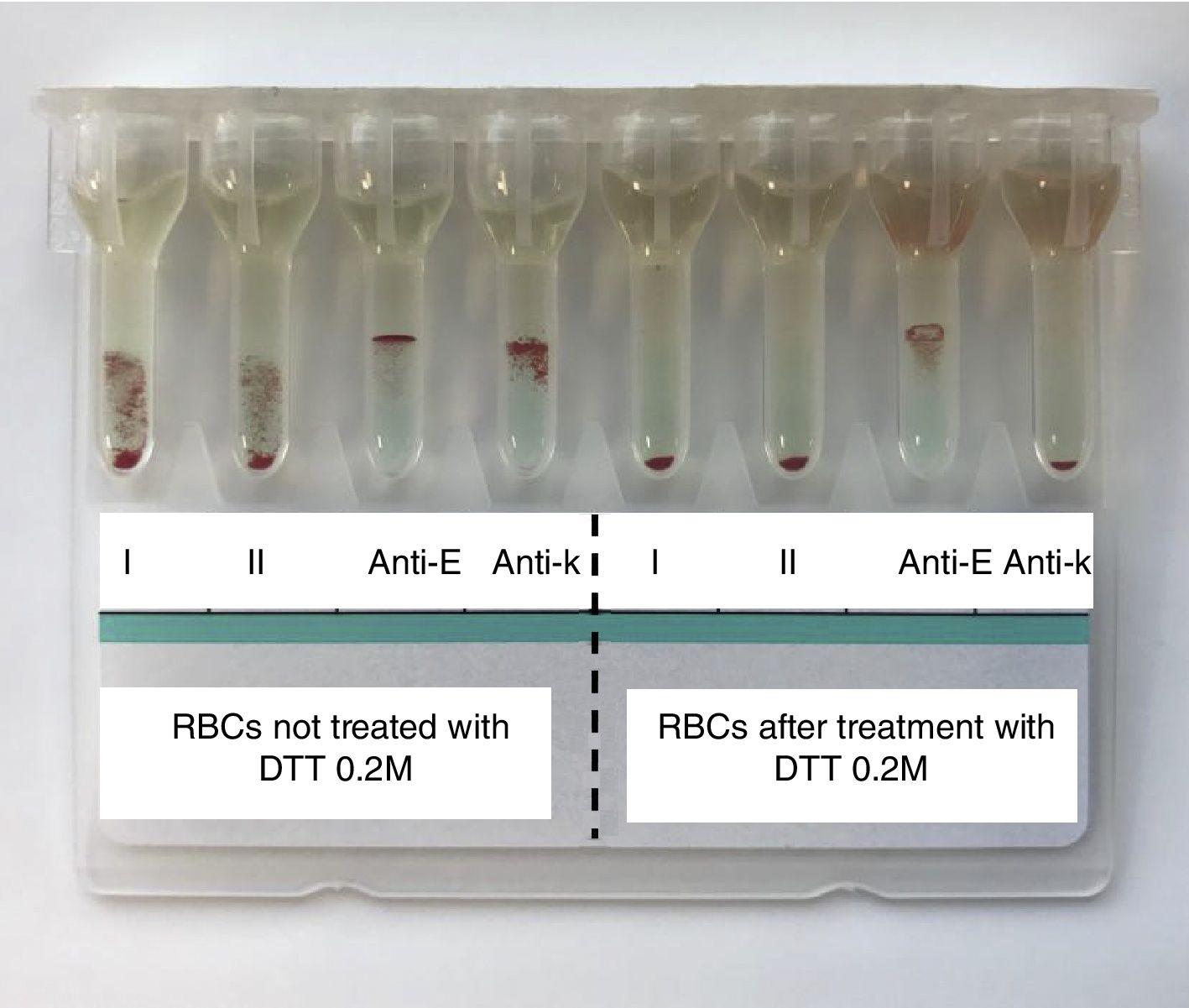 Transfusion management for patients taking an anti-CD38 monoclonal ...