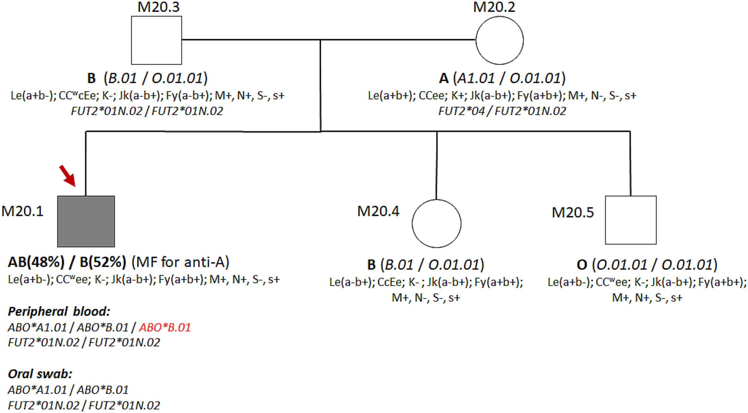 Mixed field resolution in ABO phenotyping in a rare case of a blood ...