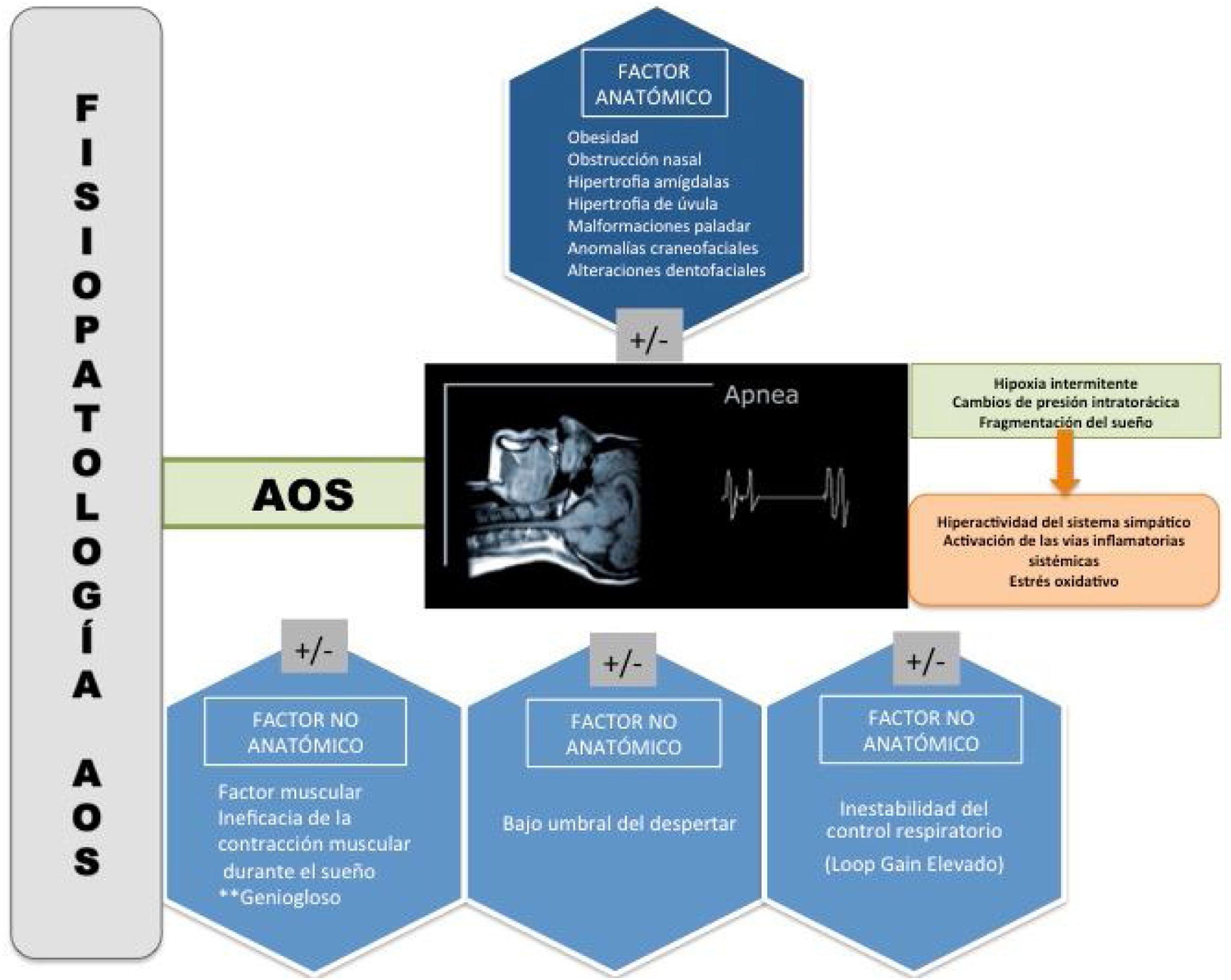 Apnea obstructiva de sueño | Open Respiratory Archives