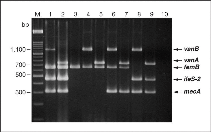 La PCR múltiple en microbiología clínica | Enfermedades Infecciosas y ...