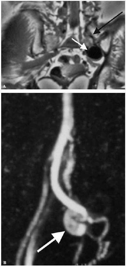 Angio-RM en el sistema osteomuscular | Radiología