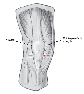 Fijación interna de avulsión de espina tibial en niños | Técnicas ...