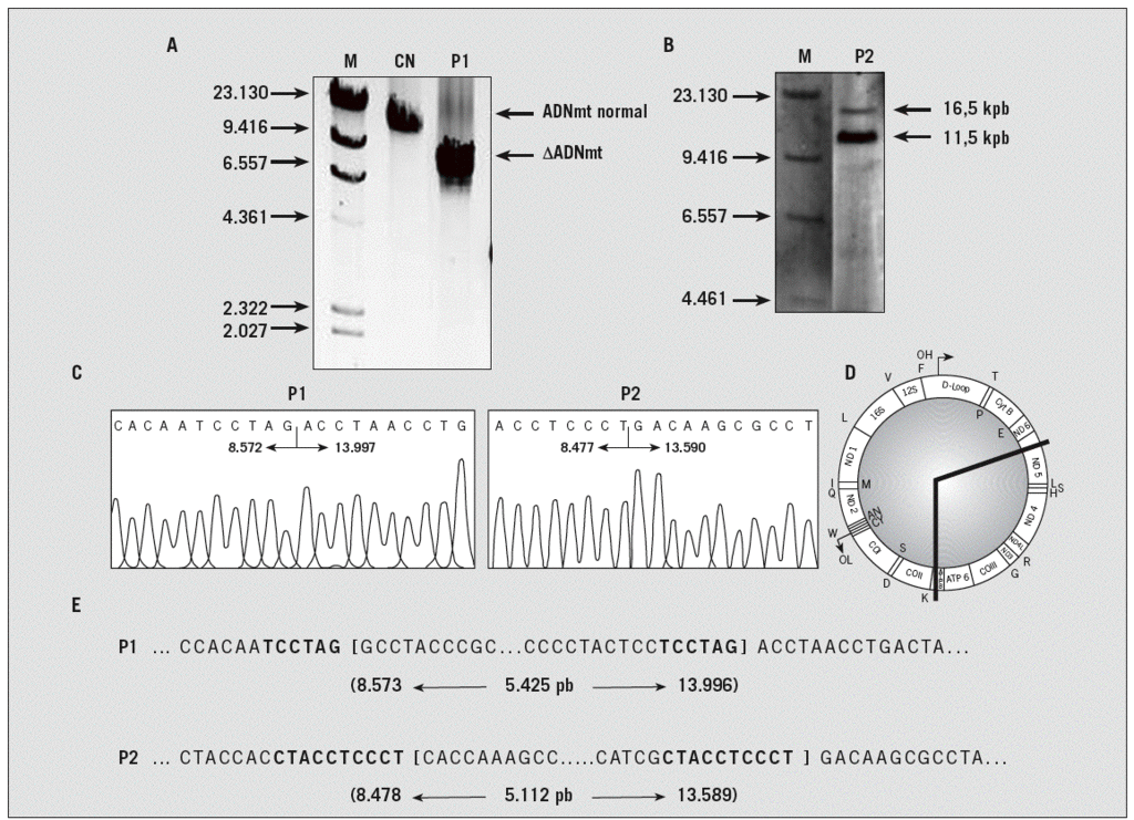 Deleciones en el ADN mitocondrial asociadas a oftalmoplejía crónica ...