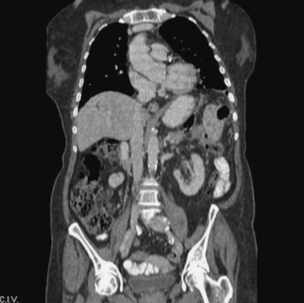 Caso 1 | Radiología