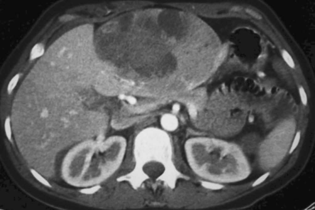 Caso 2 | Radiología