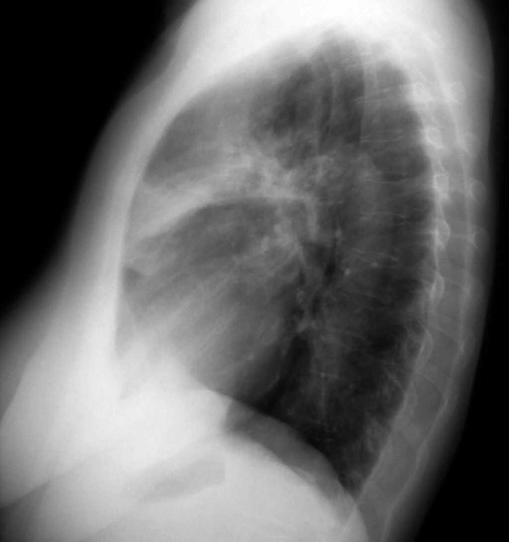 Casos en imagen:3 | Radiología