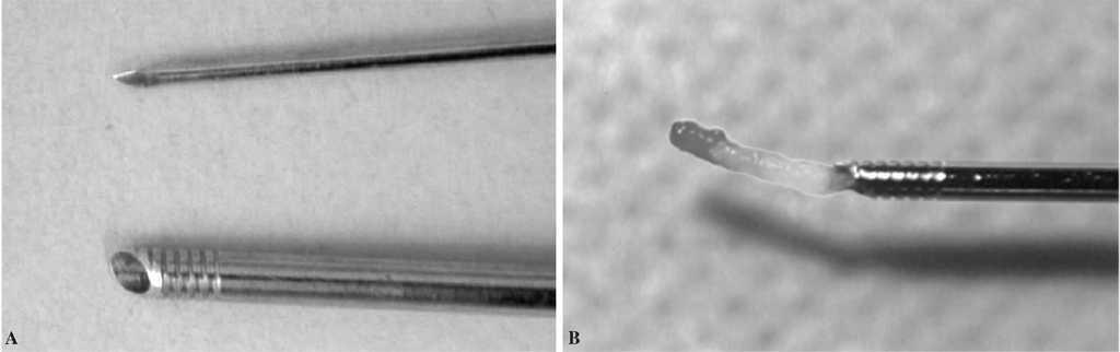 Fiabilidad, sensibilidad, especificidad y seguridad de la biopsia ...
