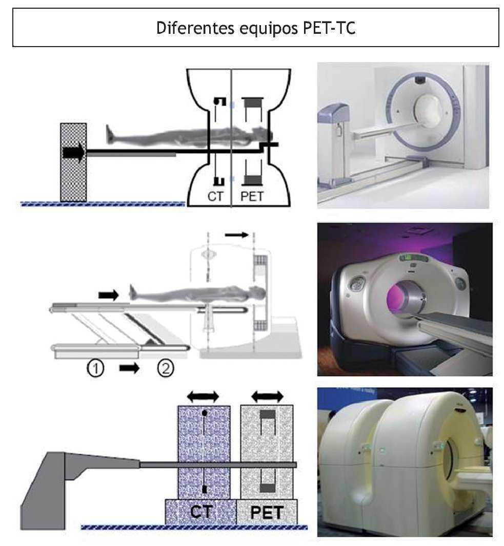 PET-TC en oncología: la importancia de un equipo multidisciplinar ...