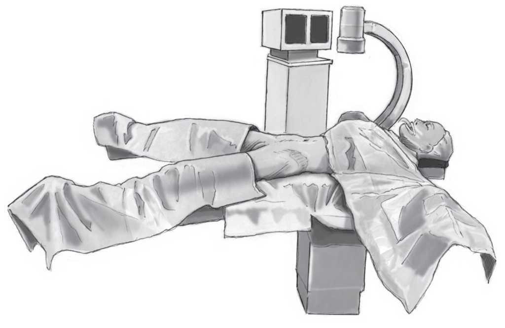 Colocación de una prótesis de disco intervertebral lumbar Prodisk ...