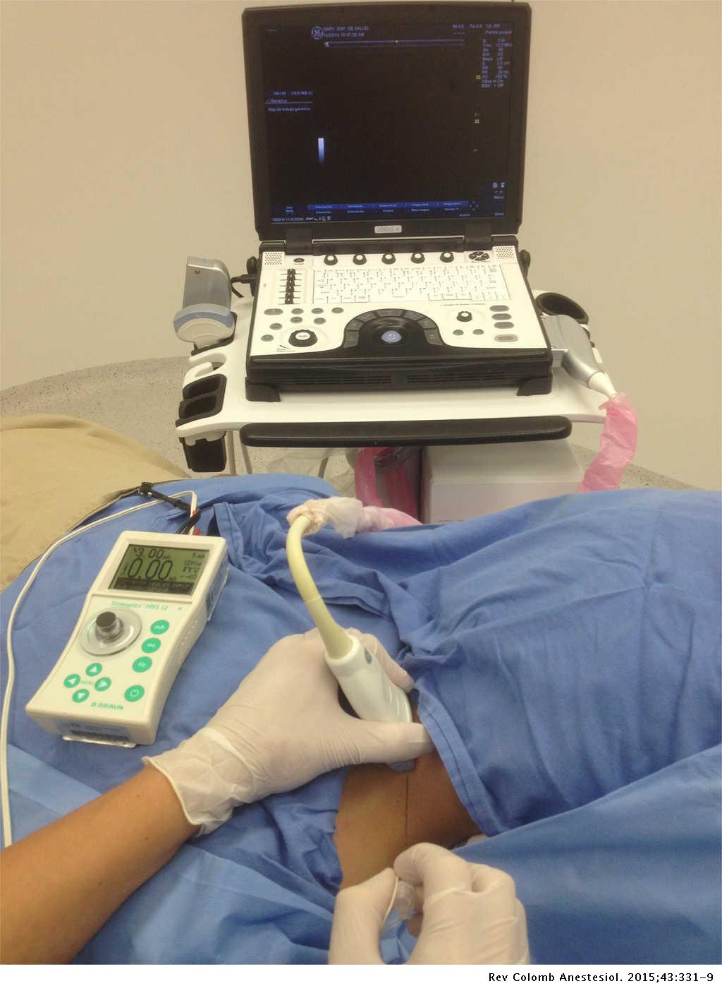 Pdf Comparison Between Ultrasound Guided Supraclavicu - vrogue.co Pdf Comparison Between Ultrasound Guided Supraclavicu - vrogue.co