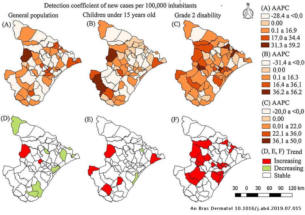 Epidemiological Monitoring Of Leprosy Indicators In Sergipe 2001 2015 Segmented Regression epidemiological-monitoring-of-leprosy-indicators-in-sergipe-2001-2015-segmented-regression