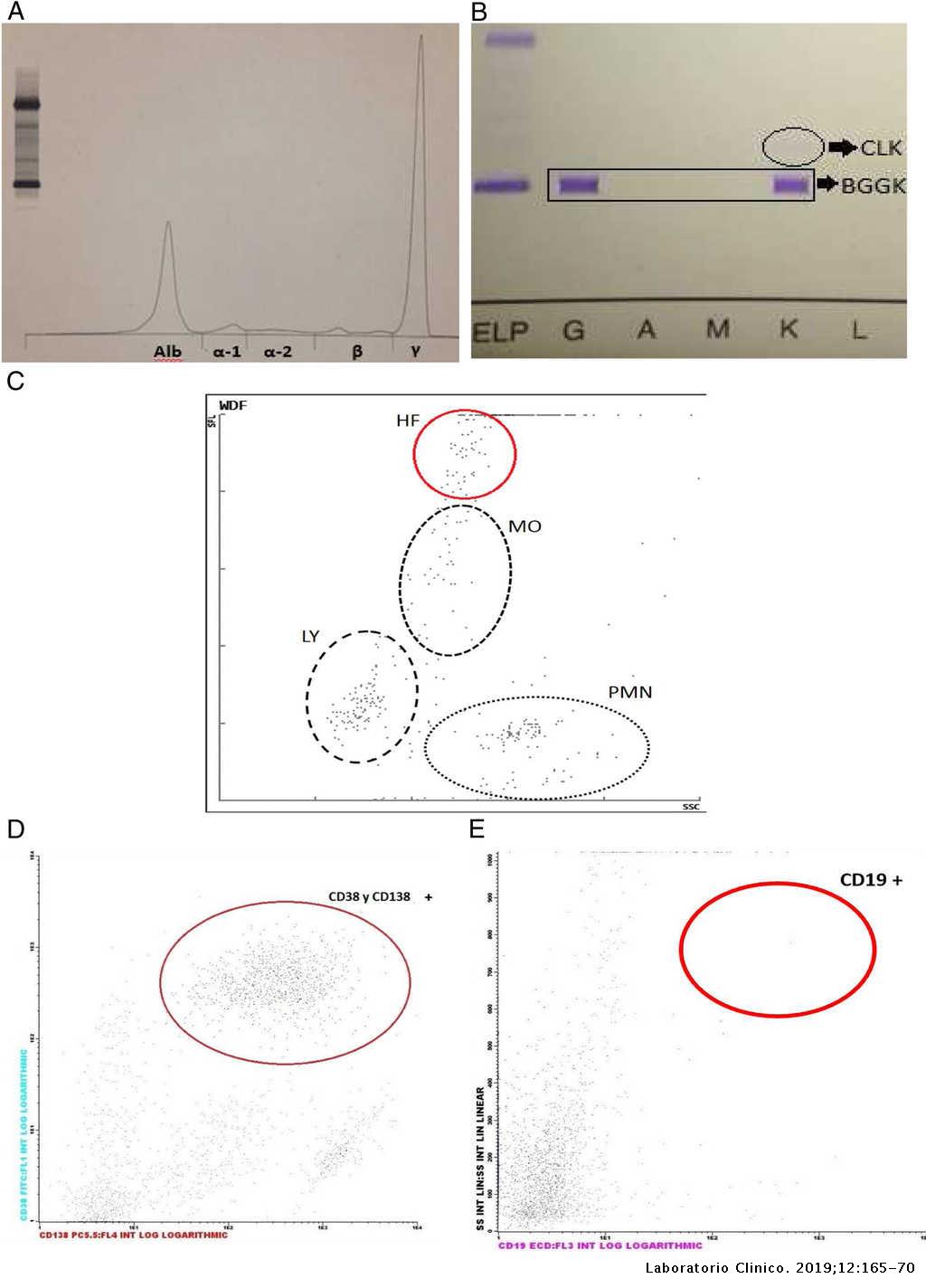 Papel Central Del Laboratorio En El Diagnóstico De Un Caso De