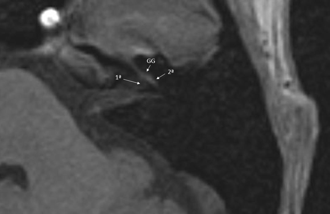 Checklist for the evaluation of magnetic resonance imaging in ...