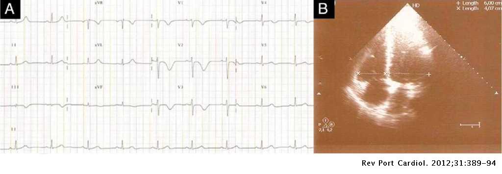 Pregnancy And Acute Pulmonary Embolism A Case Report Revista