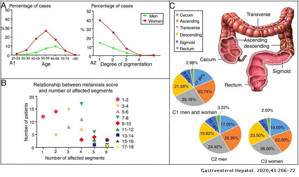 Melanosis coli: A comprehensive review | Gastroenterología y ... Melanosis coli: A comprehensive review | Gastroenterología y ...