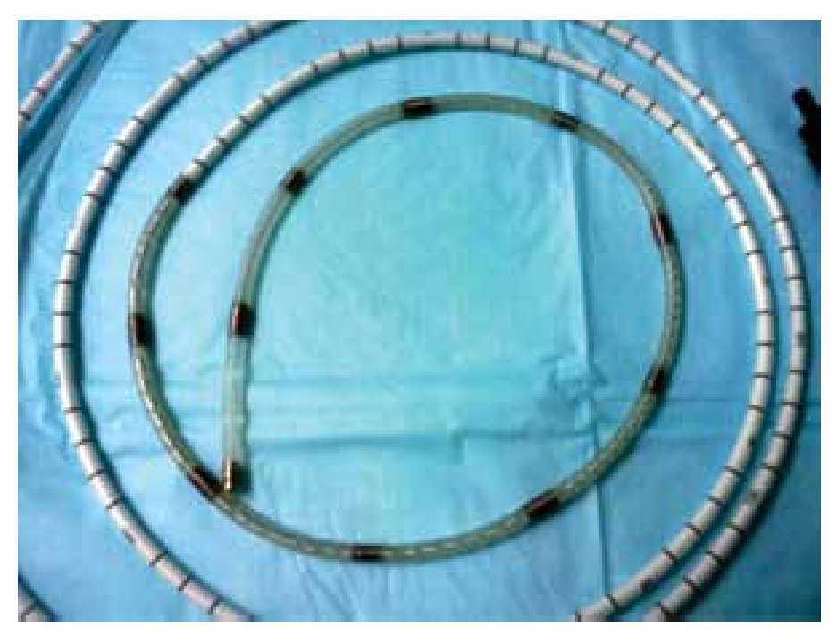 Role of endoscopic procedures in the assessment of gastrointestinal ...