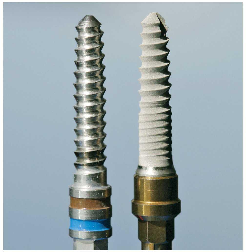 El tratamiento con implantes básico en odontología y en medicina oral y ...