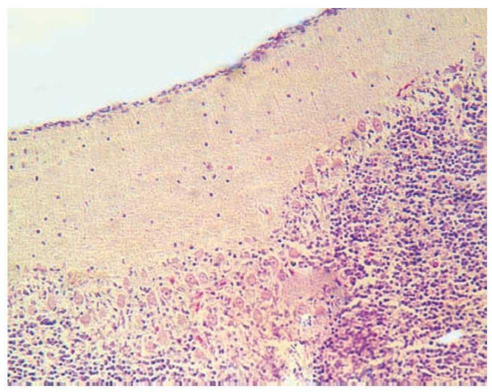 Importancia del binomio corazón-cerebro en el manejo integral de las ...