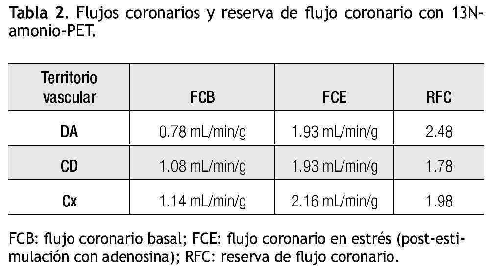 Importancia de la cuantificación del flujo coronario mediante PET. en ...