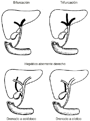 Estudio no invasivo de variantes anatómicas de la vía biliar y ...
