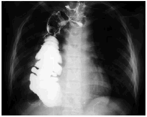 Radiografía de tórax | Medicina Integral