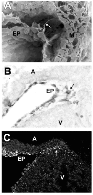 The Epicardium and Epicardial-Derived Cells: Multiple Functions in ...