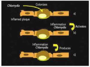 Role of Anti-Inflammatory Drugs in the Treatment of Acute Coronary ...