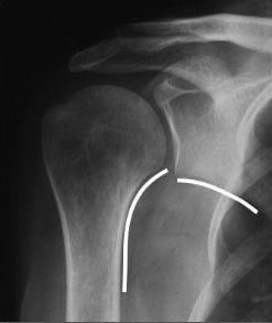 Relación entre las referencias de diagnóstico radiológico de las ...