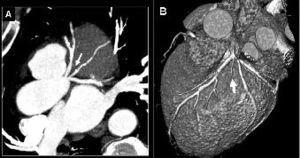 Anatomía normal, variantes anatómicas y anomalías del origen y trayecto ...