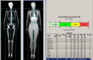 Absorciometría con rayos X de doble energía. Fundamentos, metodología y aplicaciones clínicas ...