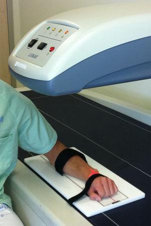 Absorciometría con rayos X de doble energía. Fundamentos, metodología y aplicaciones clínicas ...